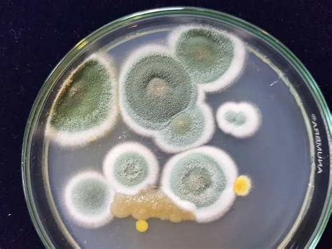 نمونه‌ای از محیط کشت حاوی قارچ‌های بیمارگر گیاهی