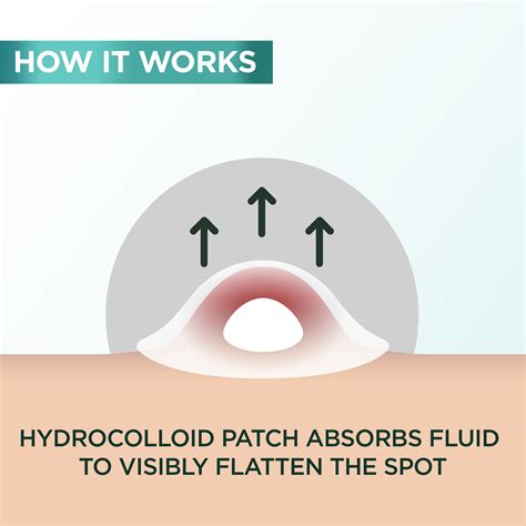 Garnier Blemish Patch Garnier Uk