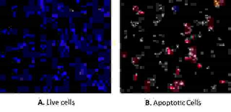 Cell Meter™ Apoptotic And Necrotic Multiplexing Detection Kit Ii
