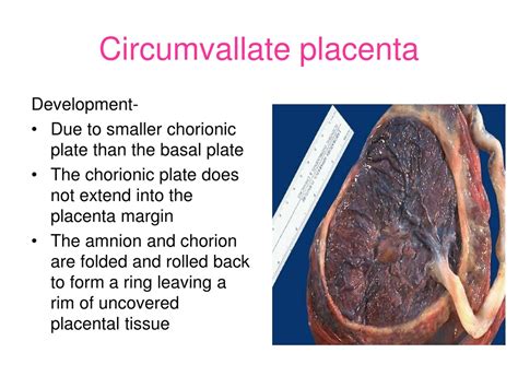 Ppt Understanding The Structure Function And Abnormalities Of The