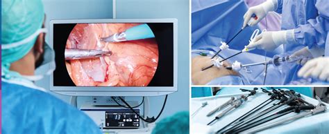 The Evolution Of Laparoscopic Instruments From Basic Tools To Cutting