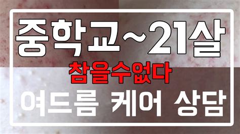 여드름을 중학생부터 달고사는 21살 여자 입니다 여드름 케어 방법 Youtube