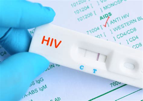 Anonymous Hiv Test Malaysia Klem Clinics