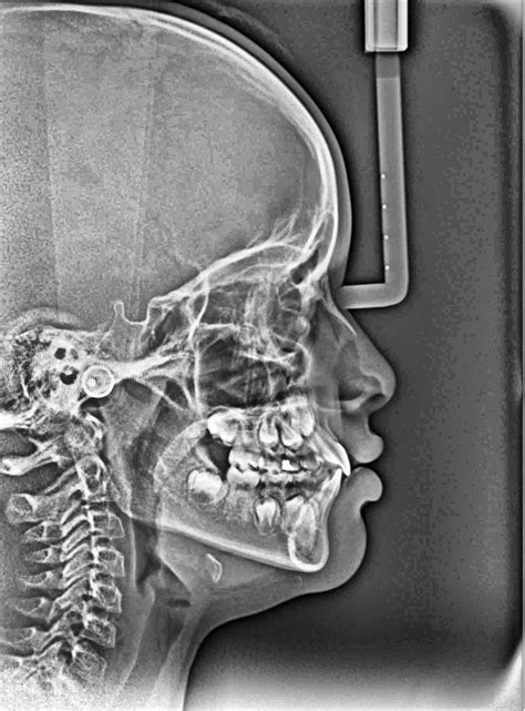 Seg100 Object Detection Dataset By Seg