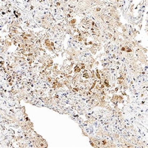 Sars Cov 2 Spike Rbd Antibody R D Systems 25 μg Unconjugated