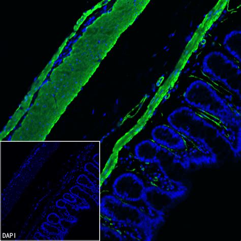 S Rmab® Alpha Smooth Muscle Actin Sma Recombinant Rabbit Mab Sdt 301