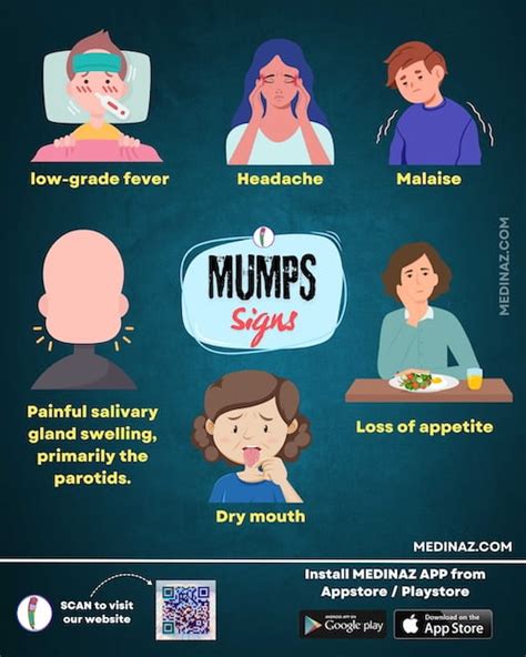 Mumps Symptoms Diagram