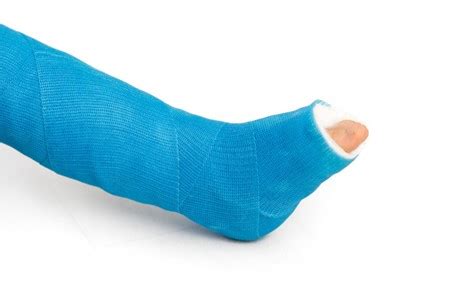 Driving With A Cast On Your Foot What You Need To Know