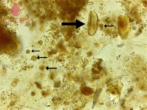 Partes Do Cisto De Entamoeba Coli Atlas Virtual De Parasitologia