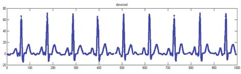 A Noisy Approximation A 7 Input Signal To The Proposed Adaptive Download Scientific Diagram
