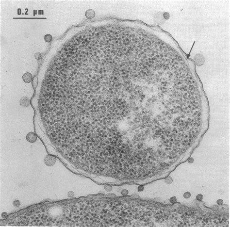 Electron Micrograph Of A Thin Section Of The Lpp Ompa Double Mutant