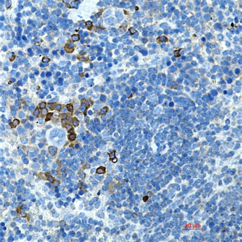 Cd272 Rabbit Mab Wb Ihc P Ip Buy Now