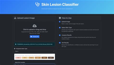 Skin Lesion Classifier Devpost