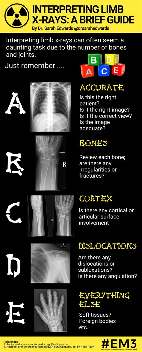 How To Read Chest X Ray Mnemonic At Brian Schurman Blog