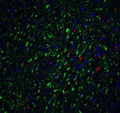 Siglec15 Antibody Wb Ihc P E Buy Now Abcepta