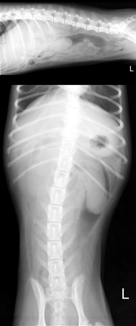 Imageileocecocolic Intussusception Radiographs Lateral And