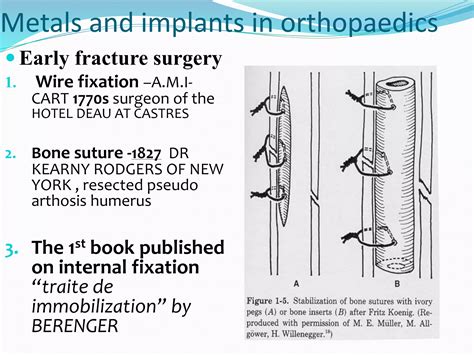 Evolution And Generation Of Orthopaedic Implants Pptx
