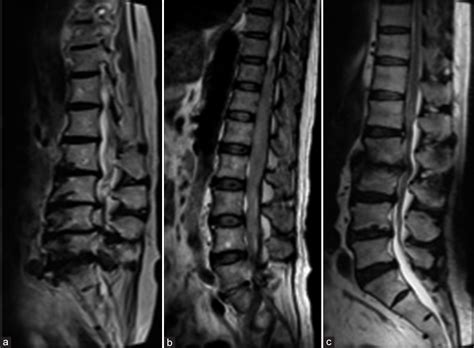 Surgical Neurology International