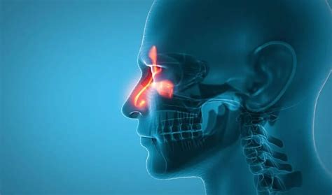 Southfield Sinus Infection Urgent Care Fast And Reliable Novahealth