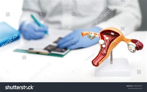 Gynecology Concept Anatomical Uterine Vagina Model Stock Photo Shutterstock