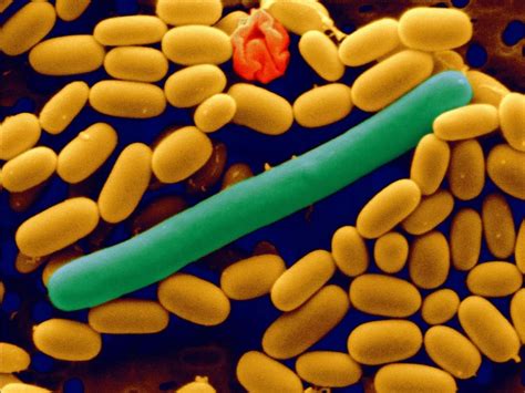 Two Dead From Cdiff Bug And 14 More Cases Being Investigated In City