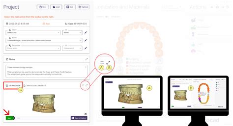 Dentaldb Application Exocad
