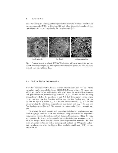 automated analysis of diabetic retinopathy using vessel segmentation