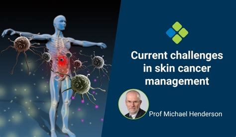 Challenges In Advanced Skin Cancer Management