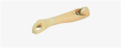 Shoulder Disarticulation Prosthesis Transhumeral Prosthesis Transradial Prosthesis 488x350