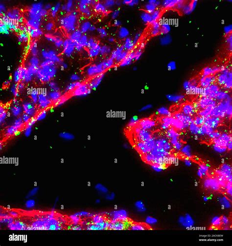 Lung Tissue Fluorescence Deconvolution Micrograph Of A Section Through