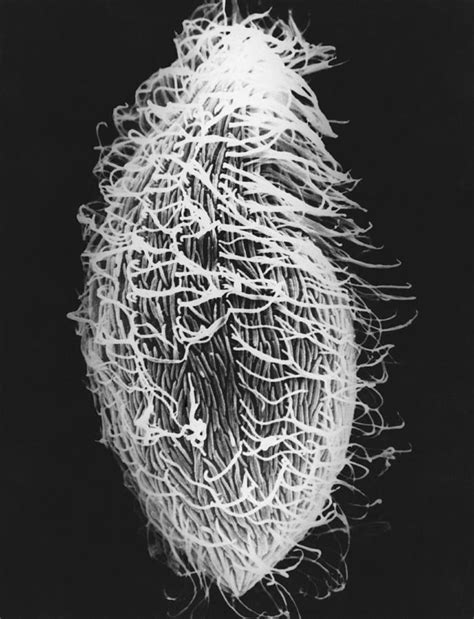 Colpidium Sp Ciliate With Surface Photograph By Greg Antipa Fine Art