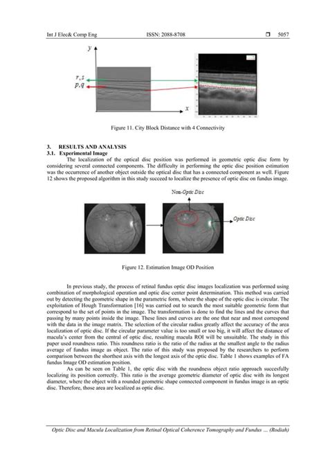 Optic Disc And Macula Localization From Retinal Optical Coherence Tomography And Fundus Image Pdf