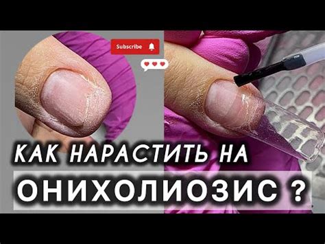 ОНИХОЛИЗИС. КАК НАРАСТИТЬ НОГТИ? ДИП СИСТЕМА - YouTube
