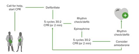 Taquicardia Ventricular Concise Medical Knowledge
