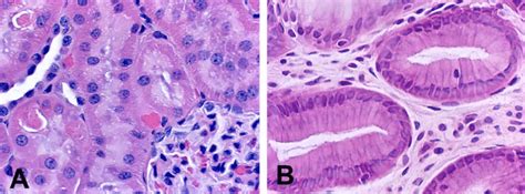 Good And Bad Formalin Fixation A Adequate Formalin Fixation Leaves Download Scientific