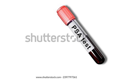 Psa Test Result Over 10 Royalty Free Licensable Stock Illustrations