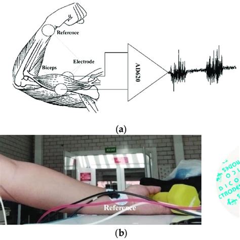 Frequency Spectrum Of EMG Signal Download Scientific Diagram