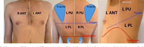 Figure 1 From Automatic Deep Learning Based Pleural Effusion