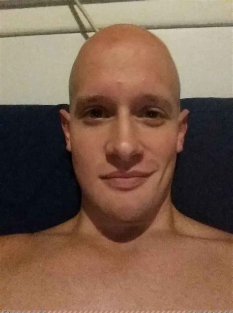 Pic Wtf Mrsa Tuesdays 55102b My R Wtf Favs