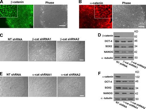 The Effects Of Depleting α And β Catenin On Colony Formation And