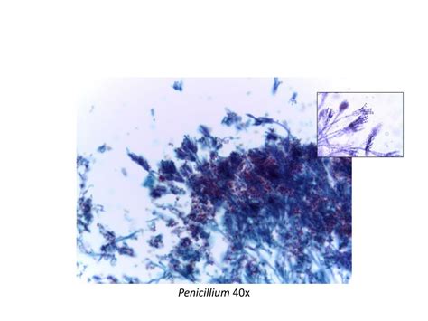 Penicillium Slide
