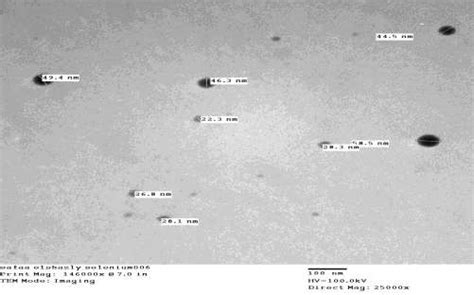 Transmission Electron Image Tem Of Selenium Nanoparticles Download Scientific Diagram
