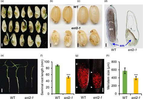 Figure 1 From CTP Synthase Is Essential For Early Endosperm Development By Regulating Nuclei