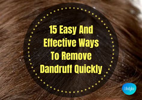 15 Easy And Effective Ways To Remove Dandruff Quickly Lifestylica