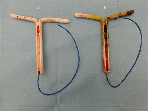 The Controlled Internal Drug Release Cidr Devices Removed From The