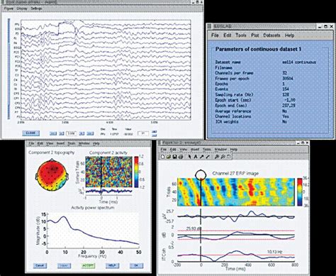 Electronic Program Guide India Namesmaster