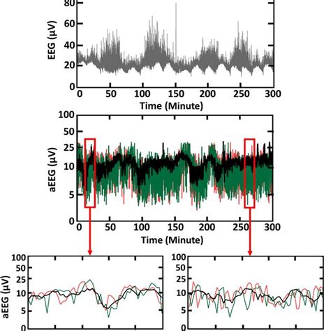 An Example Of Three Aeeg Tracings In μv Obtained Using A M1 B M2 Download Scientific