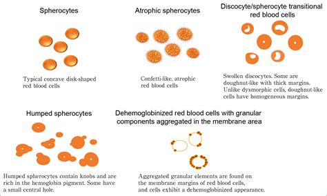 A Urinary Sediment Examination