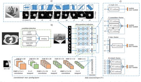 Figure 2 From Pulmonary Nodule Detection In Ct Images False Positive Reduction Using Multi View