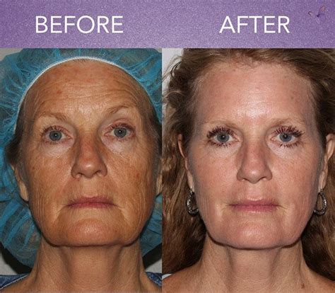 Dr Sid Mirrafati Drsidmirrafati Twitter